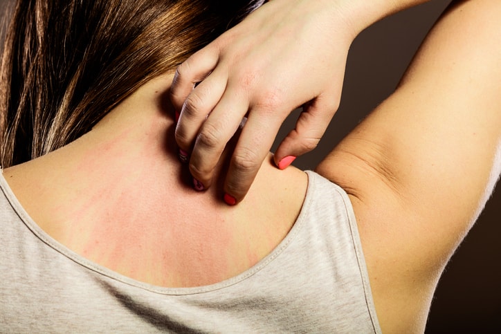 Rhinitis or Skin Allergies? Your Pillow, Bedsheets, and Blanket Could ...